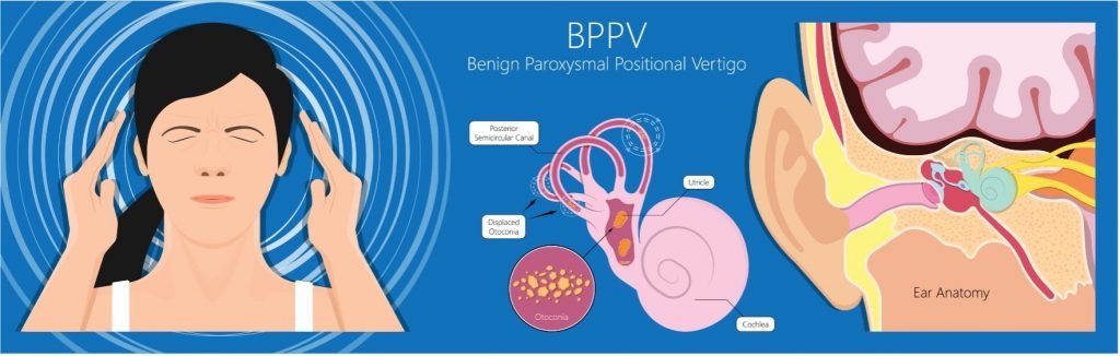 Benign Paroxysmal Positional Vertigo (BPPV) | Ear Studio